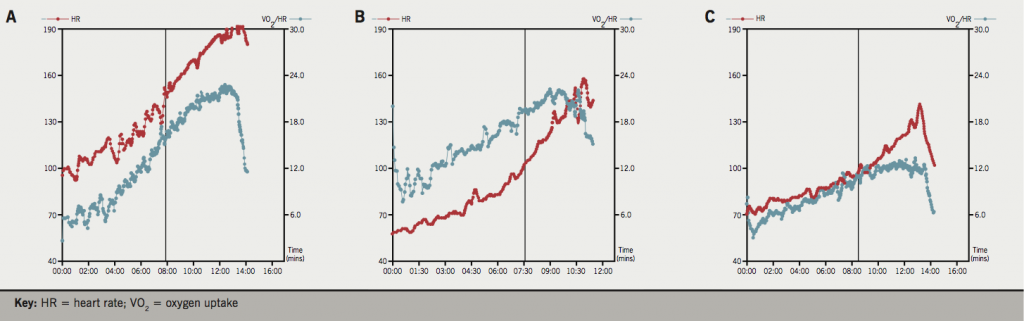 Healthcare professional’s guide to cardiopulmonary exercise testing ...