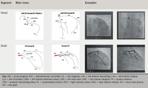 Optimal angiographic views for invasive coronary angiography: a guide ...