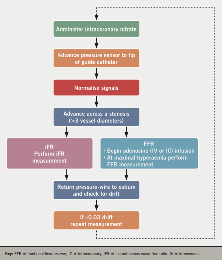 Practical basics of coronary physiology - The British Journal of Cardiology