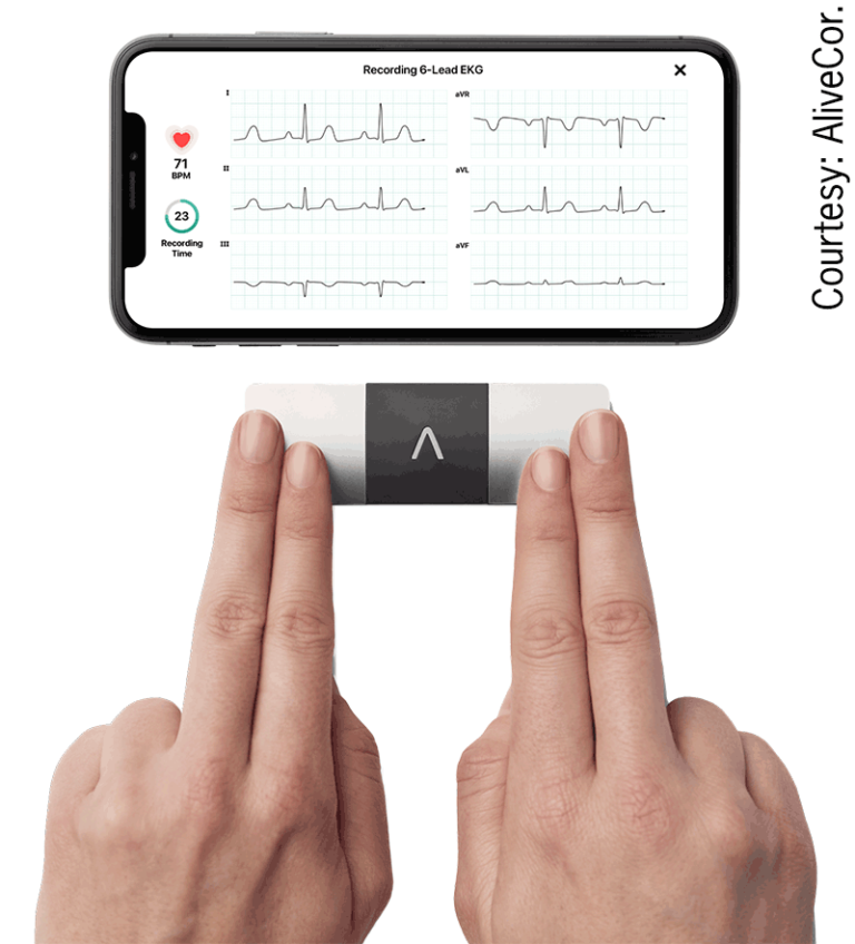 Personal recording devices for arrhythmia detection