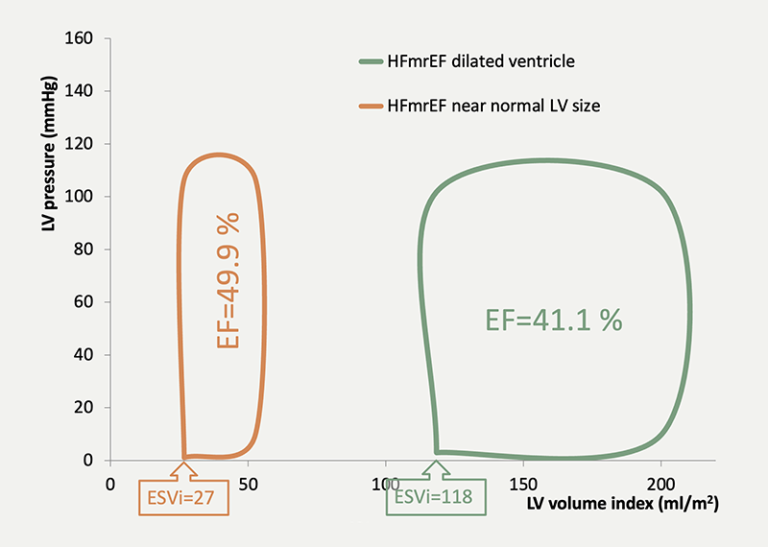 Cardiac ejection fraction as a problematic metric for heart failure ...
